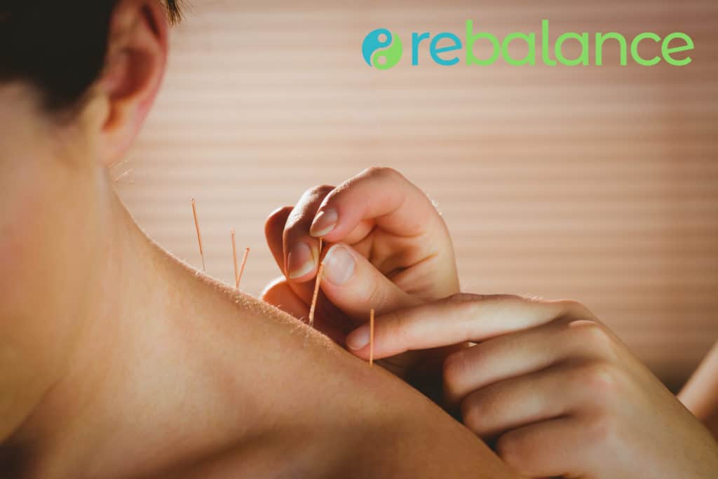 Rebalance Acupuncture Edmonton - Highly Effective Holistic Medicine